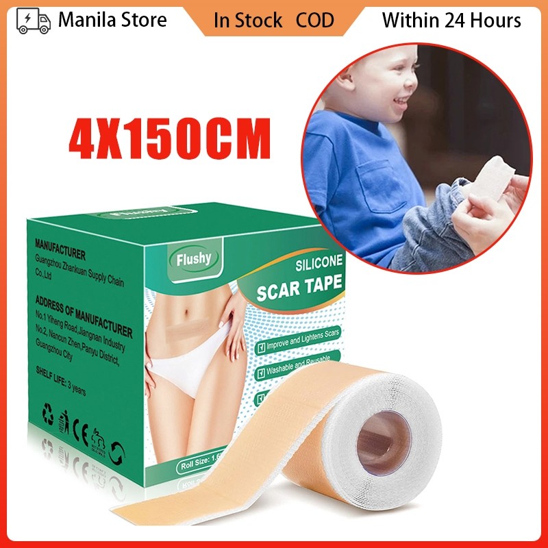1 Roll Scar Removal Gel Sheet Silicone Scar Sheets Efficient Scar ...