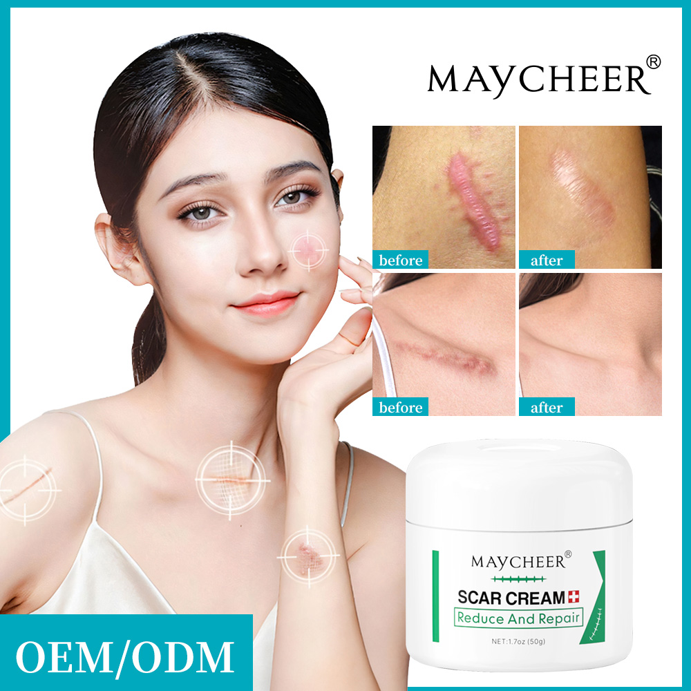 Scar Cloaking Scar Removal Cream Set restores skin confidence | Shopee ...