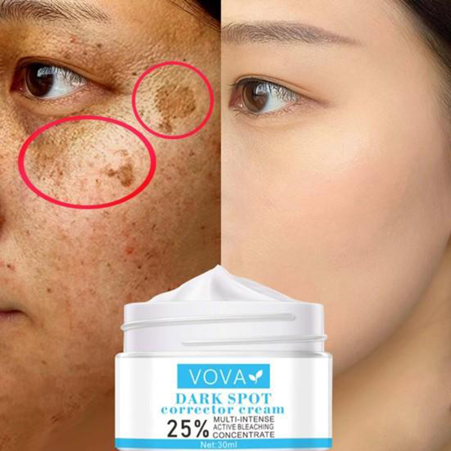 30ml black spot cream moisturizes, nourishes the skin, brightens the ...