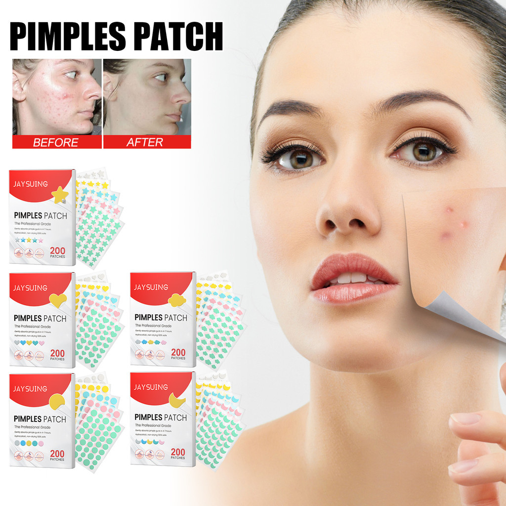 200PCS+180PCS Colorful Acne Treatment Sticker Invisible Acne Cover ...