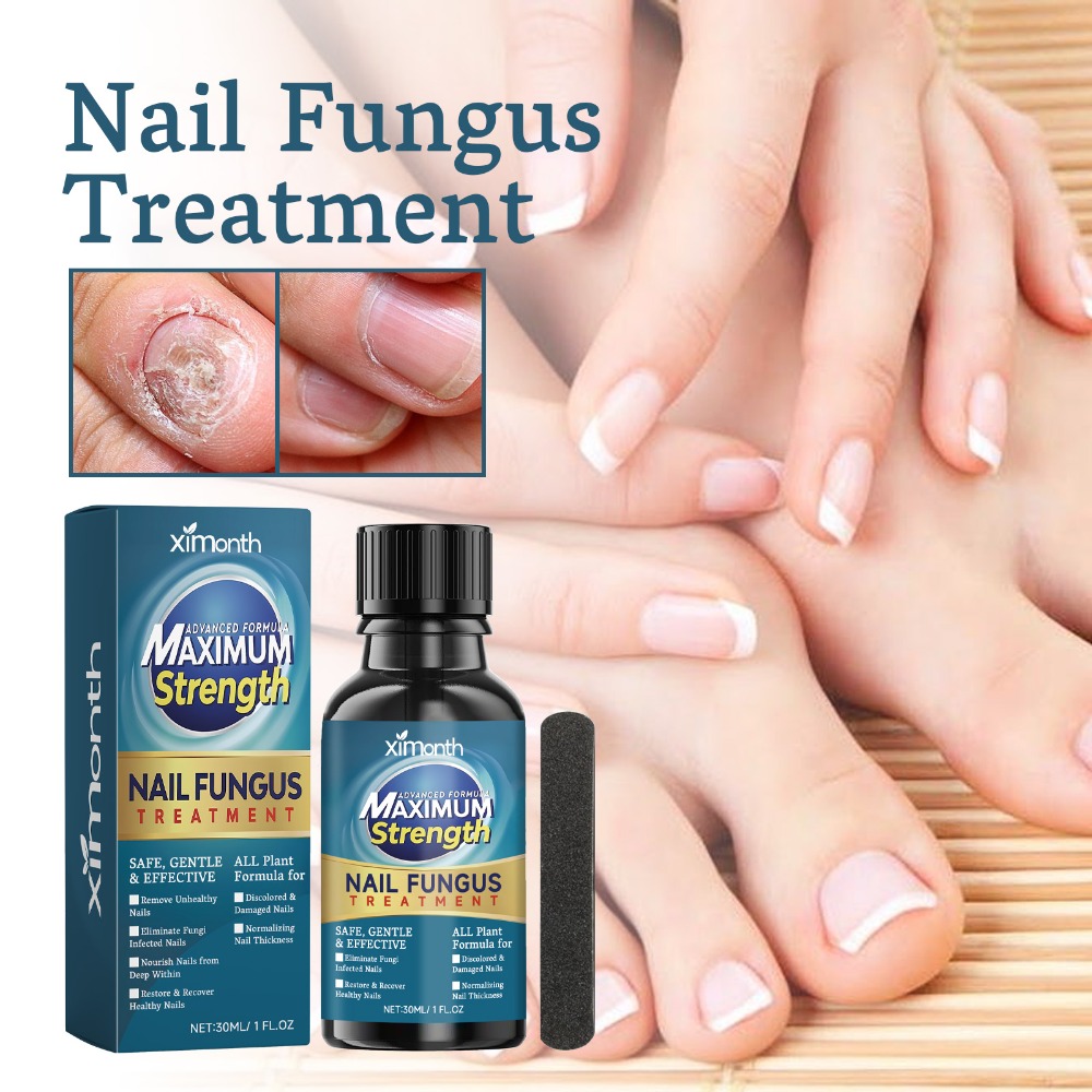 Nail Repair Treatment - Advanced Formula for Fungal Nails, Strengthens ...