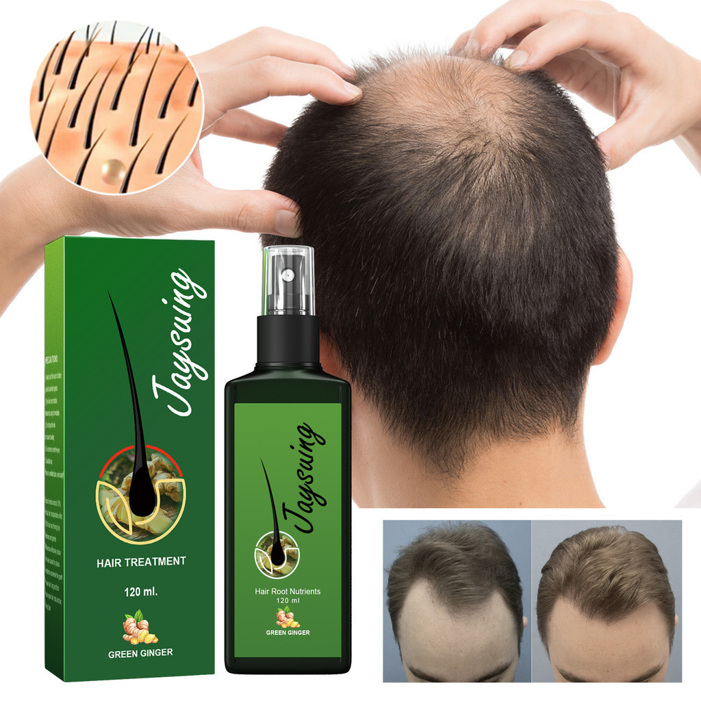 Neo Hair Original Oil Natural Solution For Thicker Hair 120ml | Shopee ...
