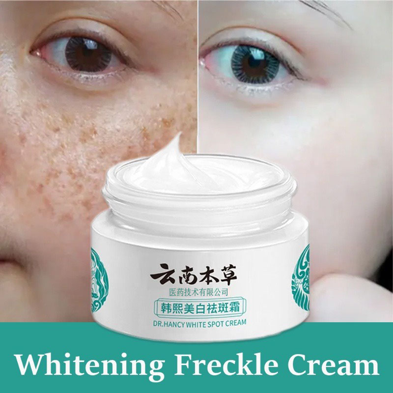 Japanese Melasma Cream Yunnan Herbal Whitening Freckle Cream Japanese ...