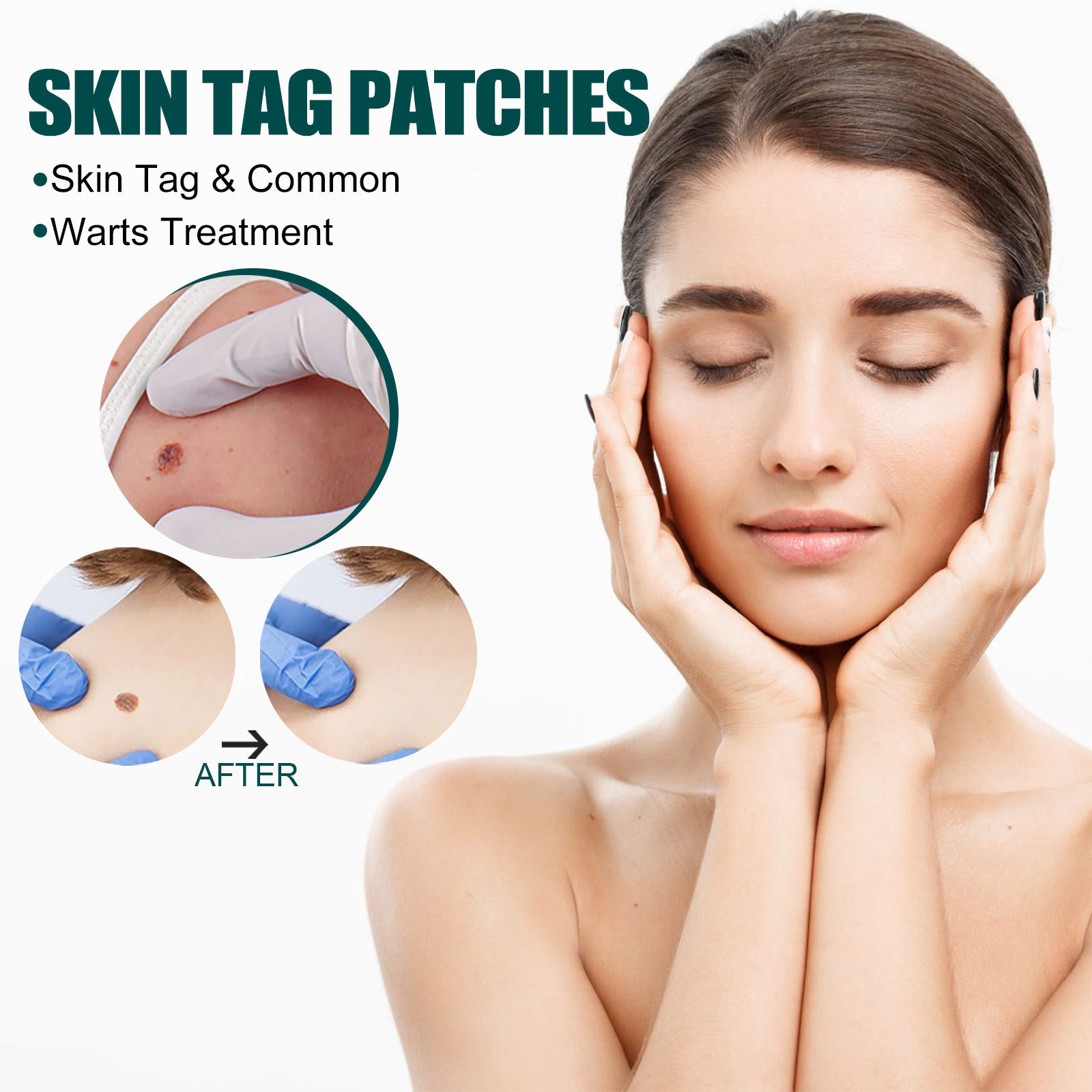 Skin Tag Patches, Wart Removal Patch, Repair Smooth Skin, Fade Facial ...