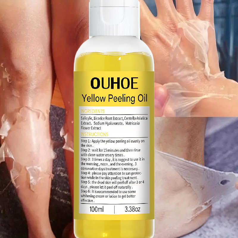 100ml Yellow Peeling Oil for Dark Skin, Strong Peeling Oil Extra ...