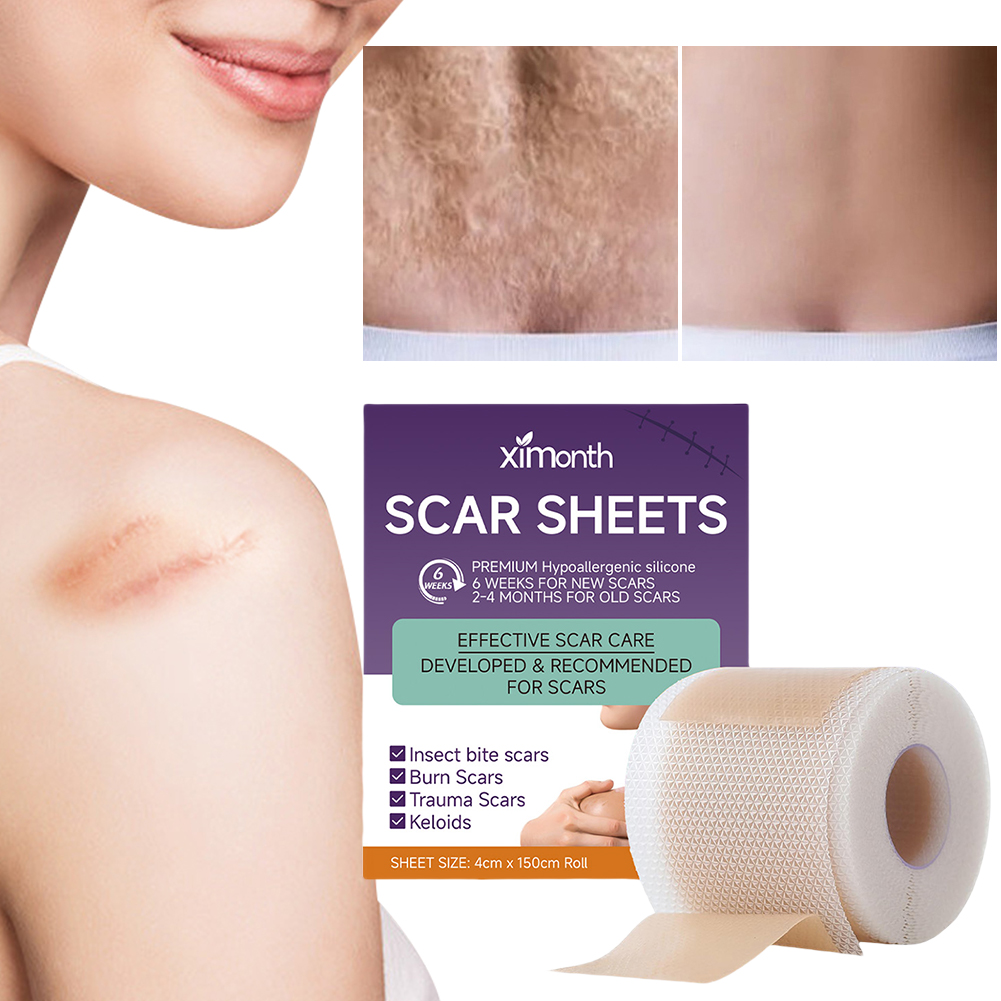 Silicone Scar Sheets Scar Patches Repair Damaged Skin Scars Covers ...