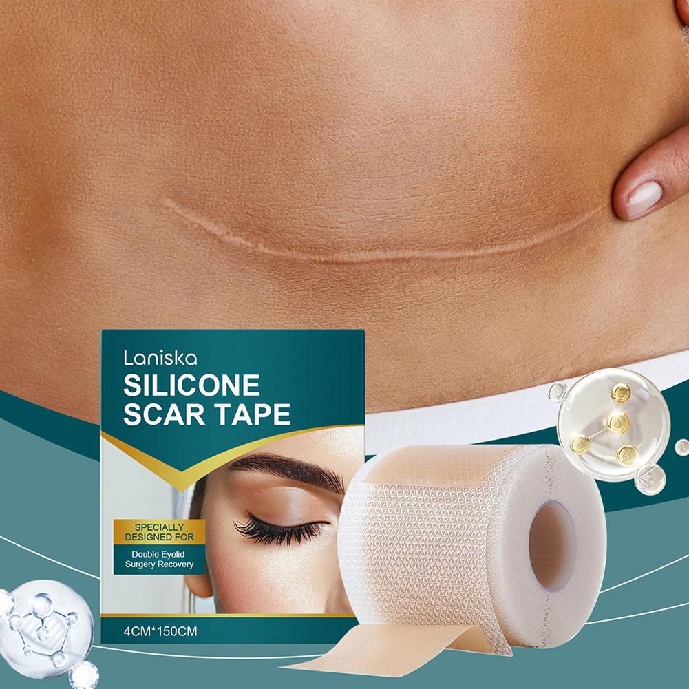 Silicone Scar Sheets,Silicone Scar Tape,Silicone Sheets For Scars BEST ...