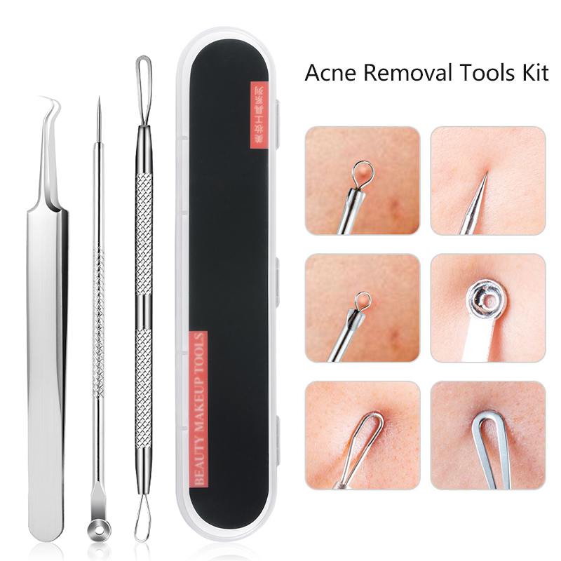 3Pcs/set Acne Removal Needle Pimple Blackhead Remover Spoon Stainless ...