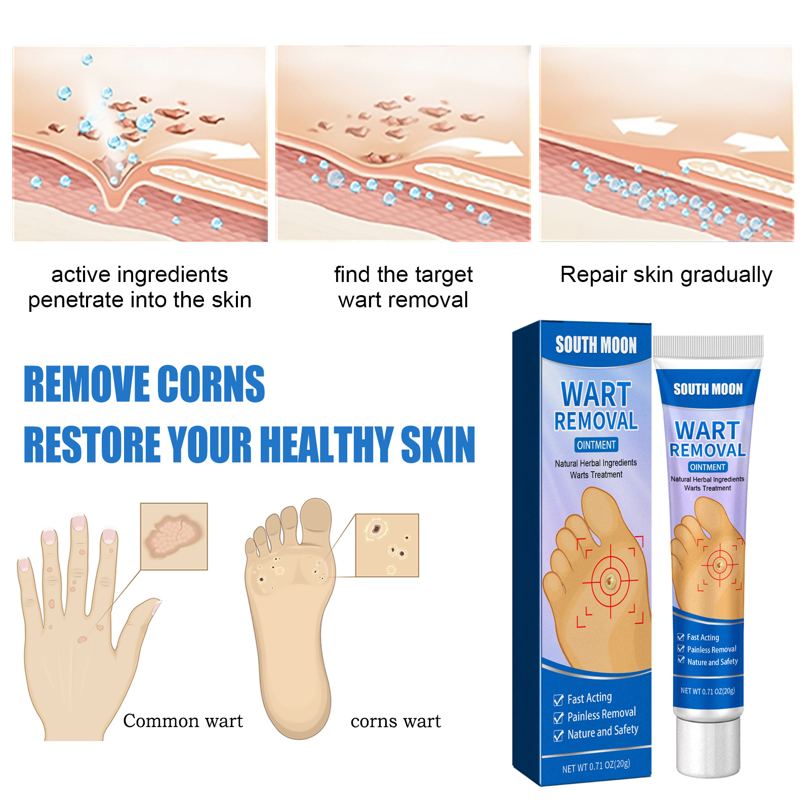 Watson Skin Tag and Mole Removal Cream with Classic Formula | Shopee ...