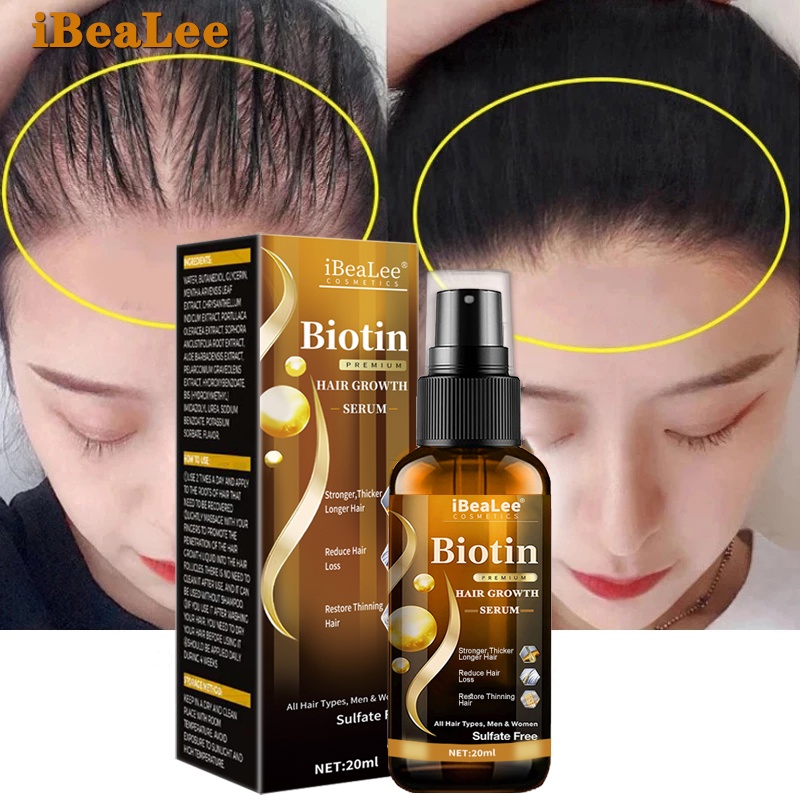 Fast Hair Growth Spray Products Anti Hair Loss Serum Prevent Baldness ...
