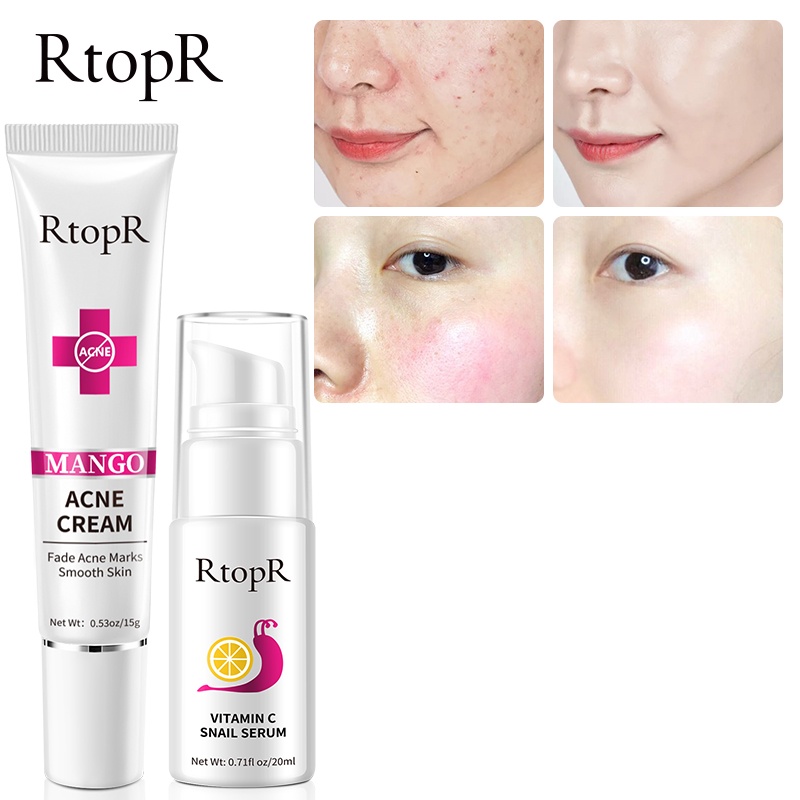 RtopR Skin Care Set: Mango repair acne cream 15g+VC Snail Serum 20ml ...