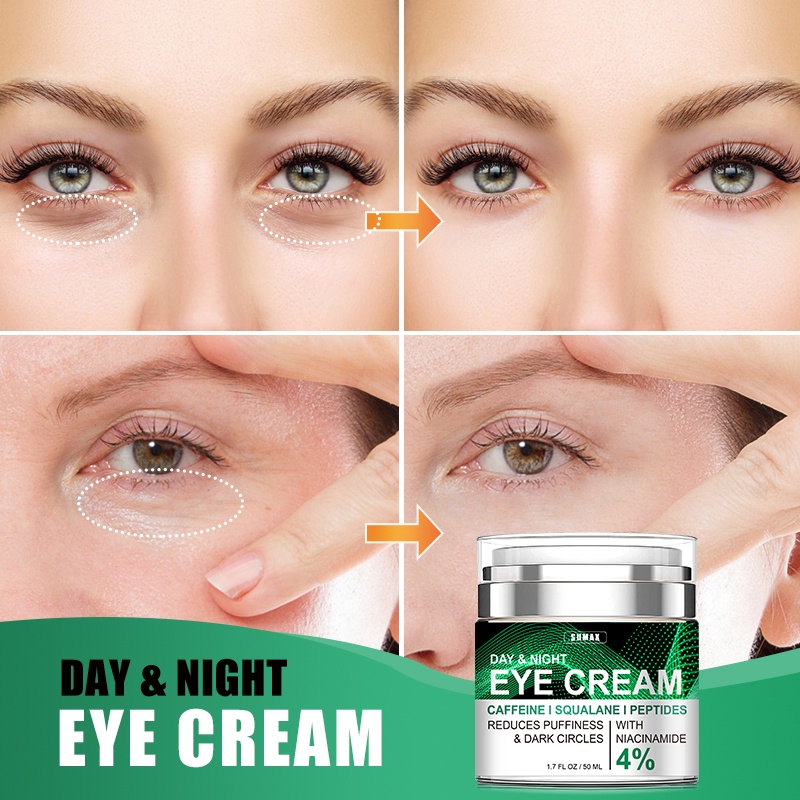 RUOALL Eye Cream for Dark Circles and Puffiness Bags Under Eyes ...