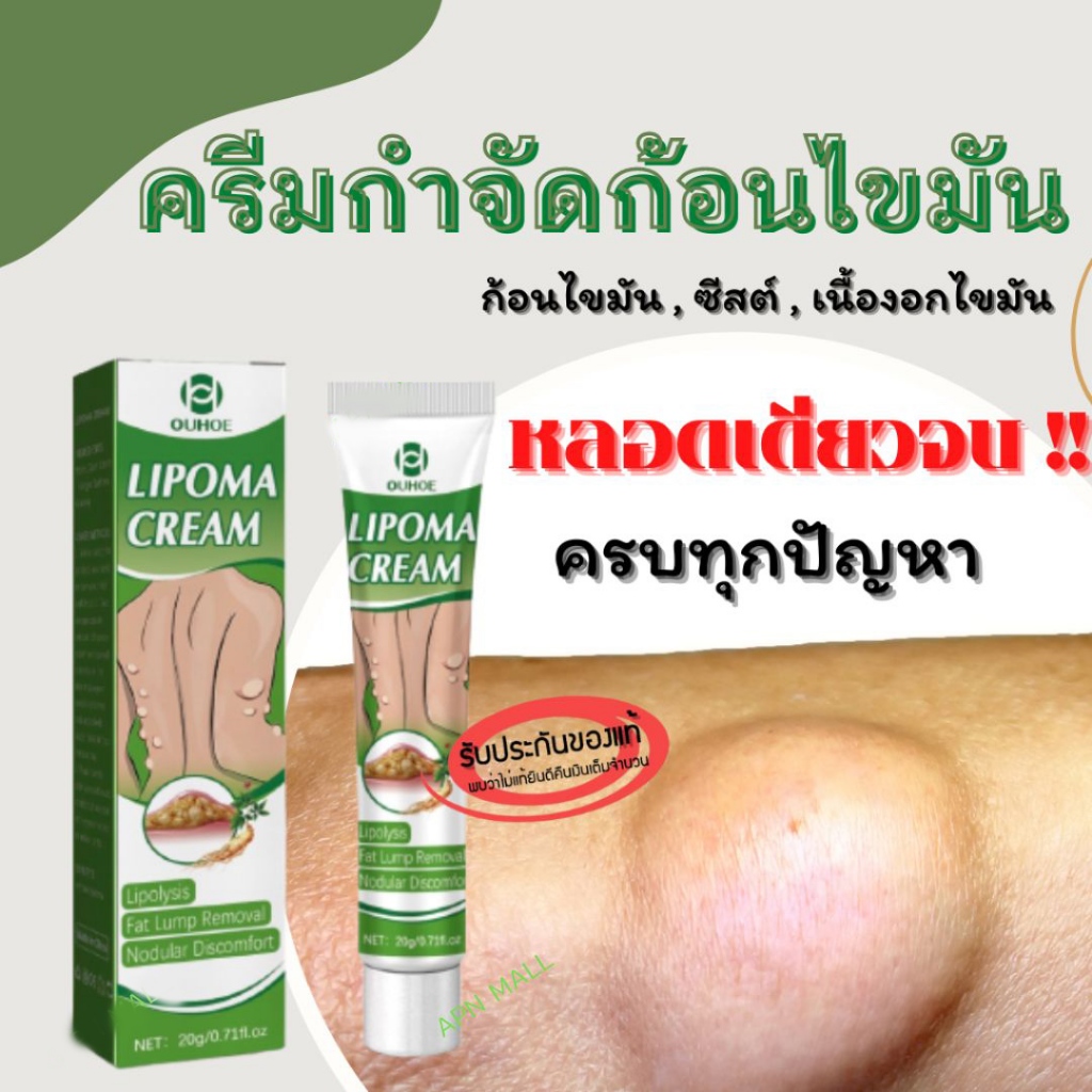 Cream To Eliminate Fat Cubes Cyst Collapse Lumps Light Texture | Shopee ...