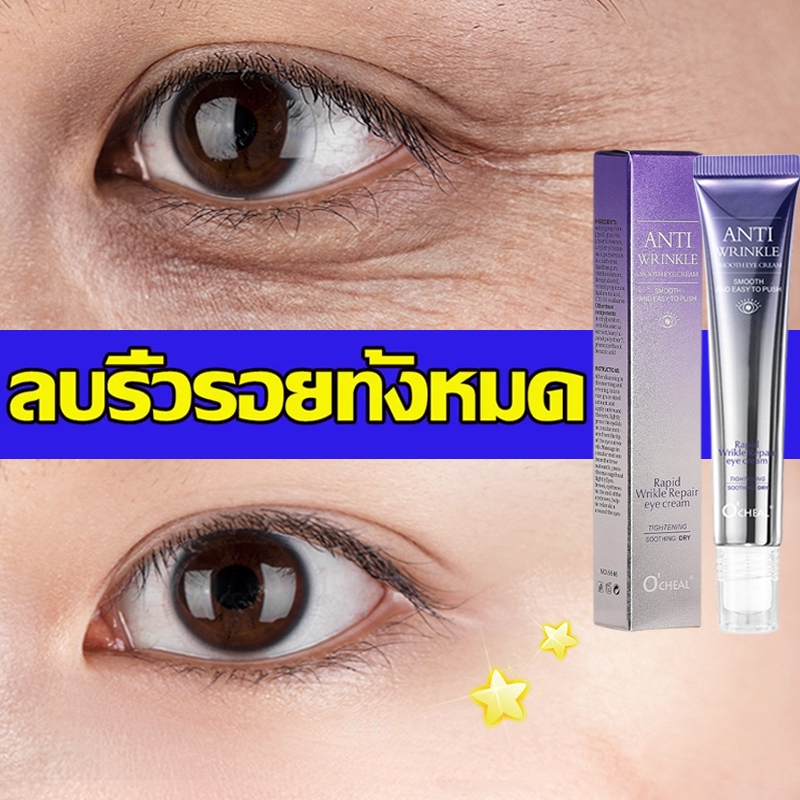 Eye Bag Reduction Cream 20g Easy To Carry Remove Dark Circles Swelling ...
