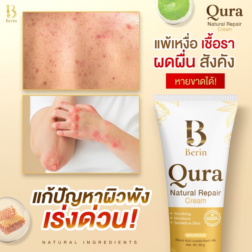Qura cream For People With Skin Problems Berin Brand Barin Rashes ...