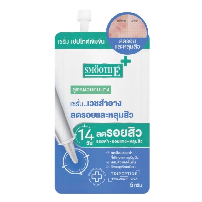 SMOOTH E Reducing SERUM ACNE SCAR (Sachet) | Shopee Philippines