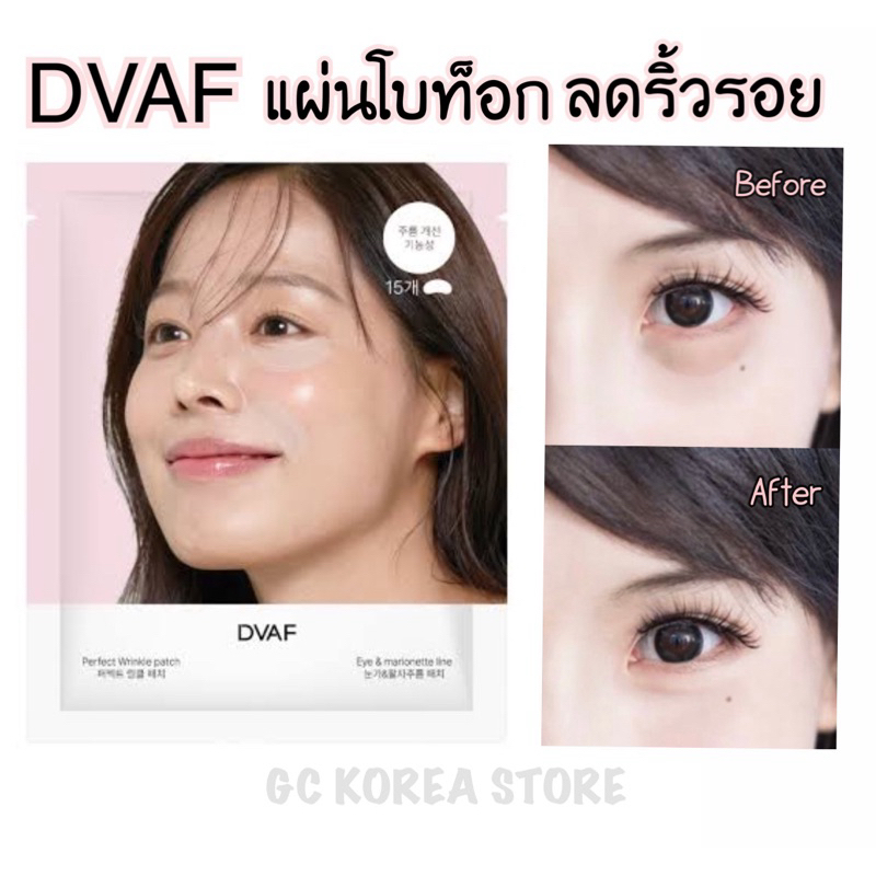 Botox Patch (15pcs) DVAF-Perfect Wrinkle Made in Korea | Shopee Philippines