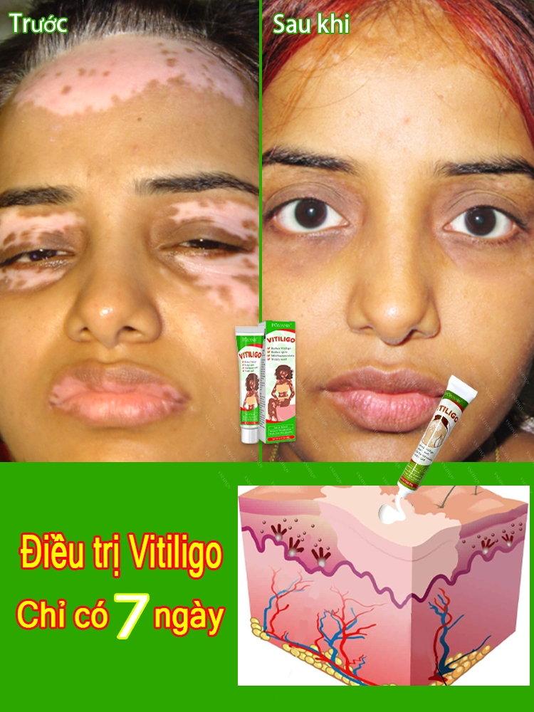 First Aid Irregular Skin Color Problems Reduce Visual Eye Circles In 7 ...