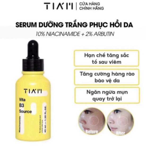 Tiam Serum Moisturizes, Whitens Skin, Controls Oil, Reduces Wrinkles ...