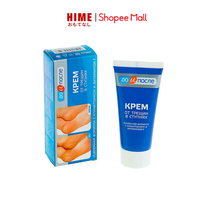 Russian Apteka Cracked Heel Relief Cream 50ml Helps Regenerate and ...