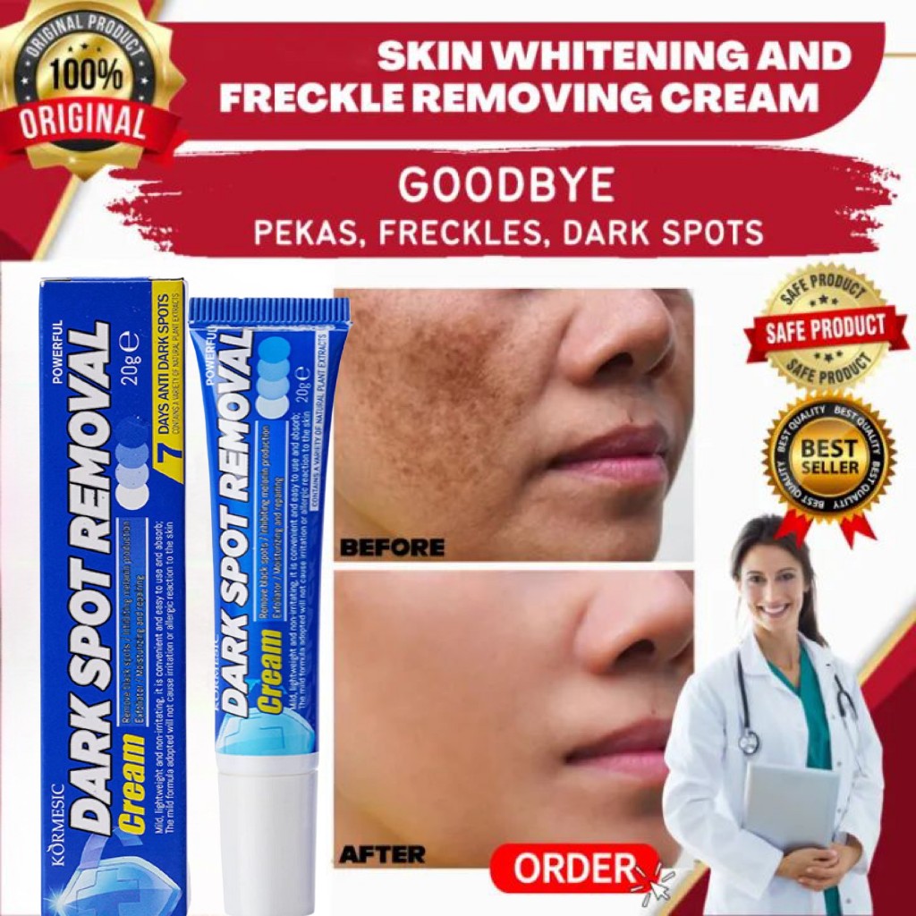 Effective Melasma Cream Pekas Remover Skin Whitening Moisturizer Anti ...