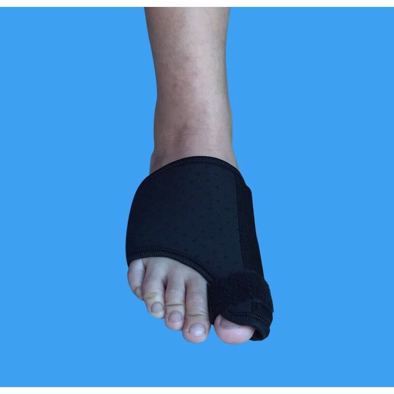 Foot brace to fix big toe | Shopee Philippines