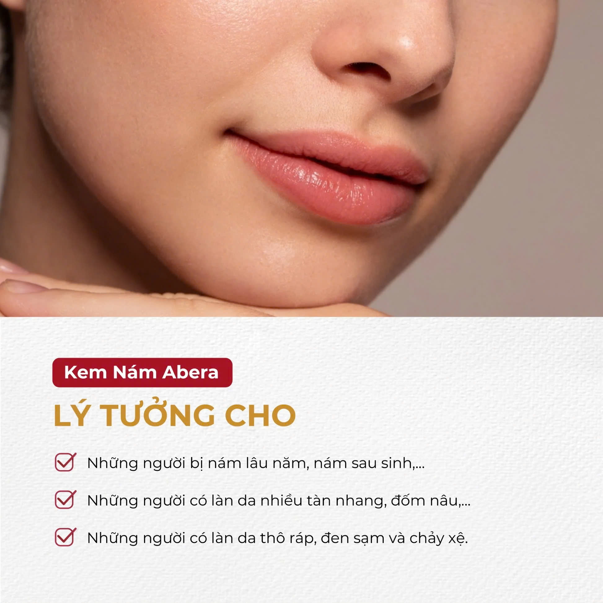 Abera Melasma Cream Fade Dark Spots, Freckles, Age Spots, Moisturize ...