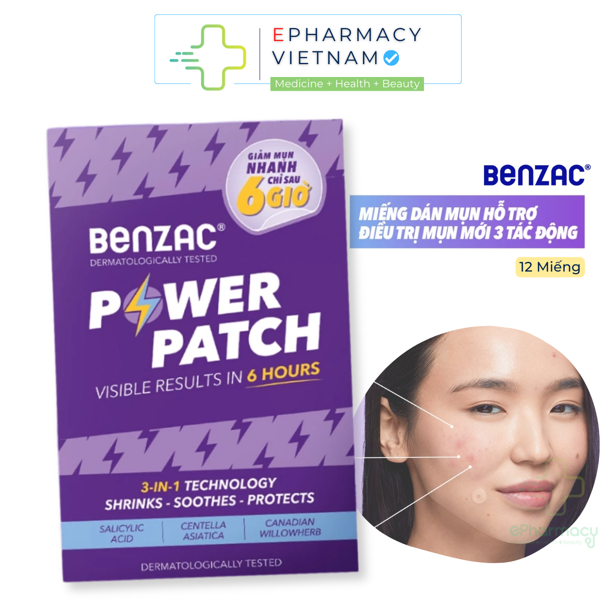 BENZAC Power Patch 3-in-1 Spot Control Acne Soothing Patch 12 Pieces ...